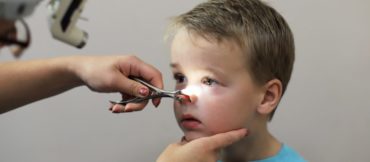 Adenoide: o que é e quando tirar - Blog Pulmolab